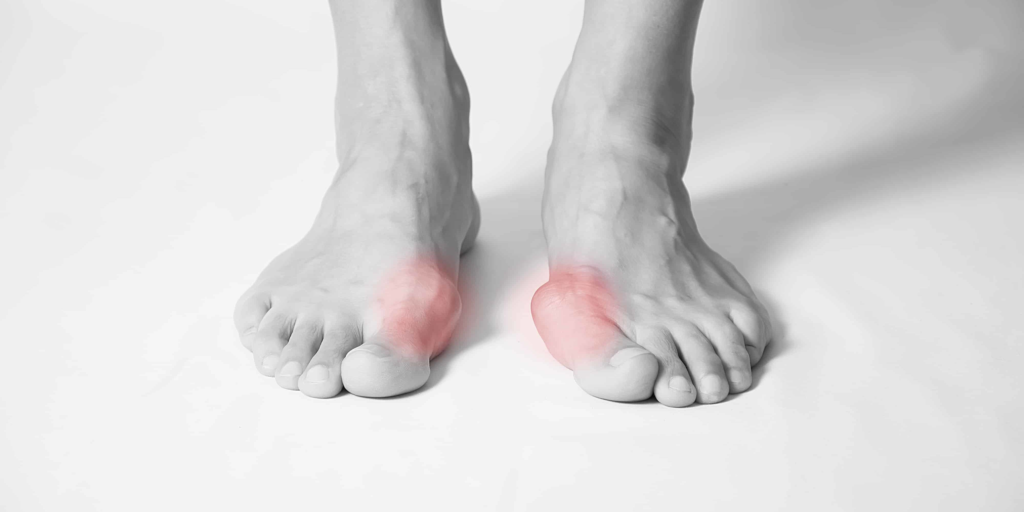 Hallux Limitus pain? Our Podiatrists can help! - Foot Mechanics